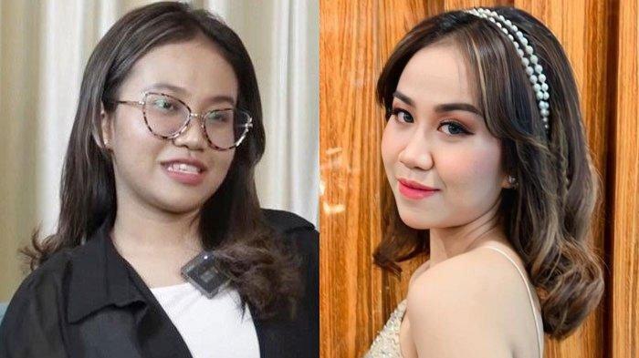 Akui Lebar, Kini Mayang Pengin Oplas Hidungnya Agar Lebih Mancung ...