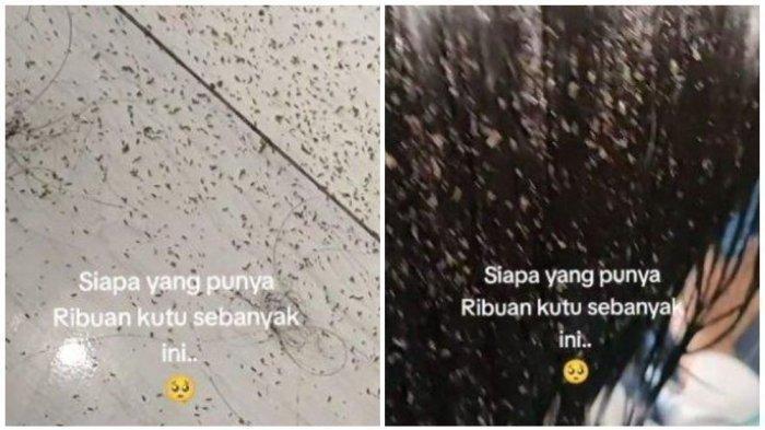 Pemilik Salon Kaget Rambut Bocah Trenggalek Penuh Ribuan Kutu, Dikira ...