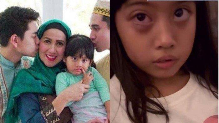 Vania Putri Venna Melinda Dilempar Batu Temannya, Matanya Sempat ...