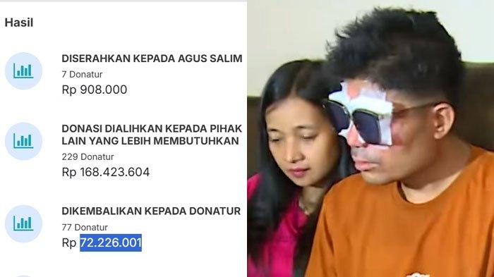 Agus Akhirnya Cuma Dapat Uang Donasi Rp900 Ribu dari Rp1,3 M, Ngambek Tak Mau Operasi: Stres ...