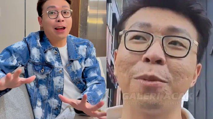 Akui Wajah Penuh Bopeng, dr Richard Lee Ungkap Dirinya Dulu Miskin ... Akui Wajah Penuh Bopeng, dr Richard Lee Ungkap Dirinya Dulu Miskin ...