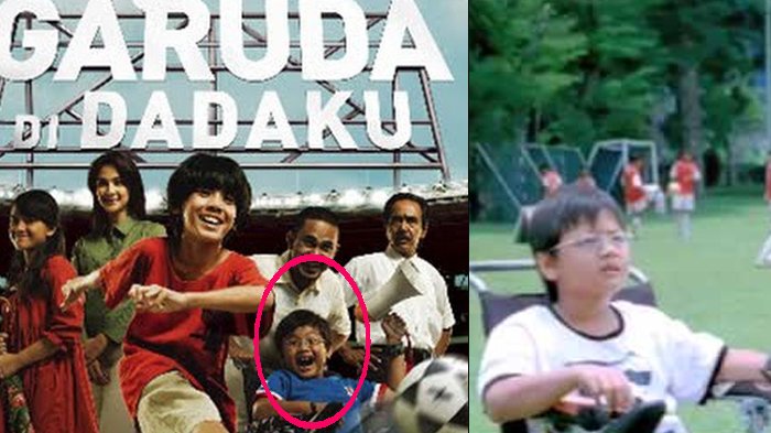 Ingat Bocah Berkursi Roda di Film Garuda di Dadaku Ini? 9 Tahun Berlalu ...