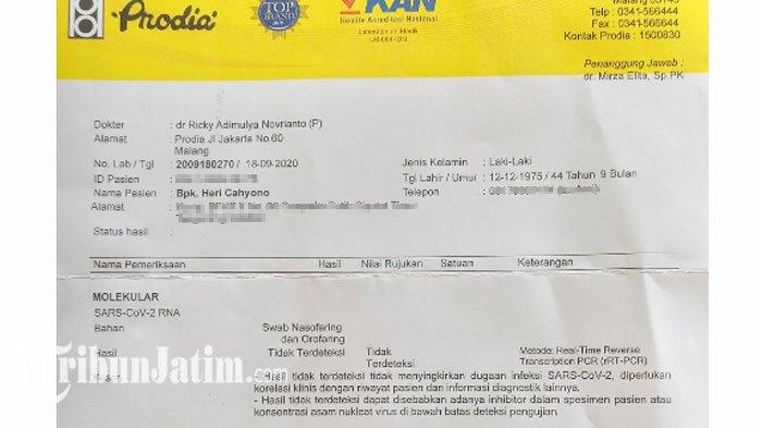 Hasil Tes Swab Sam HC 'Tidak Terdeteksi', Pelopor Malang Jegeg Ini ...