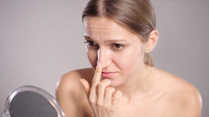 TIPS CANTIK HARI INI - Tuntaskan Komedo Putih yang Membandel dengan ...