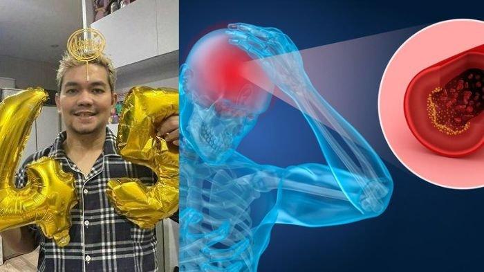 Sakit Kepala Bisa Jadi Gejala Pembuluh Darah Pecah? ini Penjelasan Penyebab hingga Cara ...