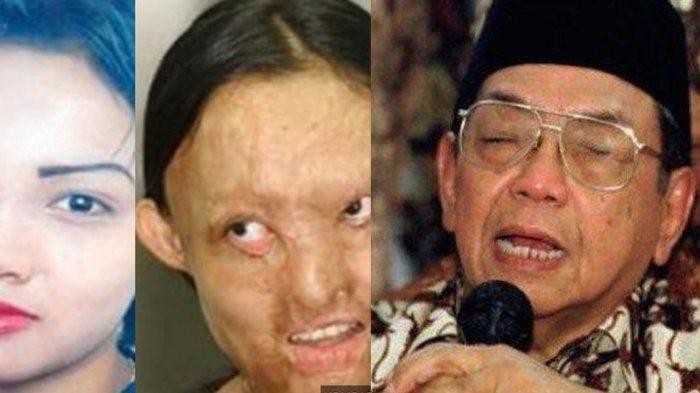 VIRAL TERPOPULER: Nasib Lisa 'Face Off' Korban KDRT - Cerita Gus Dur ...