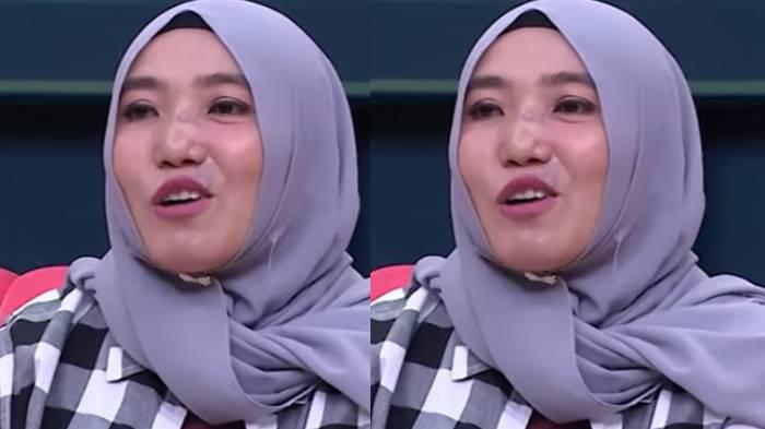 Arti Lirik 'Sikok Bagi Duo' yang Viral di TikTok, Berikut Cerita Awal Meli Dedi Nyanyikan Lagu ...