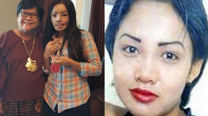 Kabar Lisa Face Off yang 14 Tahun Lalu Disiram Air Keras: Bisnis Baru ...