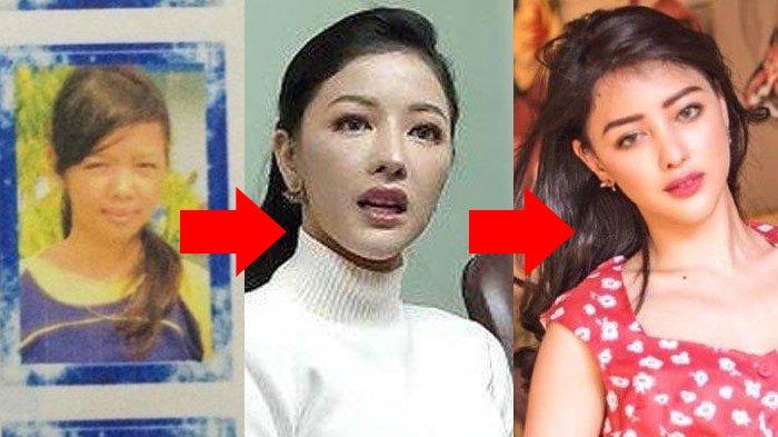 Perjalanan Transformasi Drastis Oplas Wajah Siwi Widi Eks Pramugari, dari Gadis Polos Jadi ...