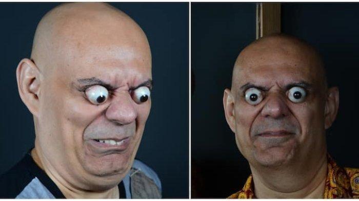 Sosok Pria Pecahkan Rekor karena Melotot, Matanya Bisa Menonjol hingga ...