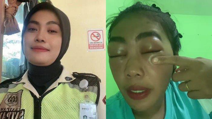 Satpam Cantik Bingung Mata Bengkak dan Bibir Jontor usai Minum Obat ...