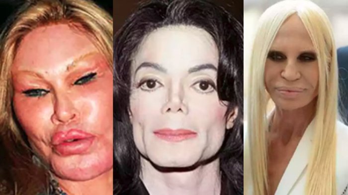 10 Foto Selebritis Pasca Operasi Wajah yang Malah Berubah Ngeri, Nomor ...