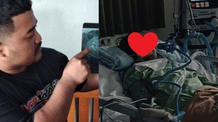 Istri Meninggal setelah Cabut Gigi Bungsu, Suami Curhat Rasa Sakit ...