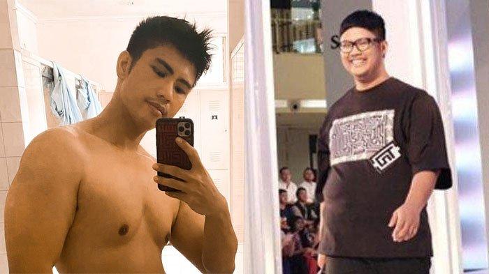 Ricky Cuaca Operasi Plastik Hidung Pasca Turunkan BB 60 Kilo, Malah ...