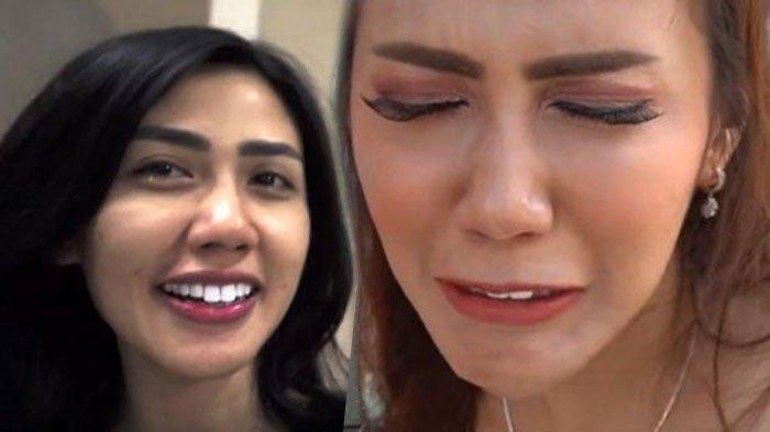 Melihat Wajah Asli Rey Utami Sebelum Lakukan Perawatan, Perhatikan Foto ...