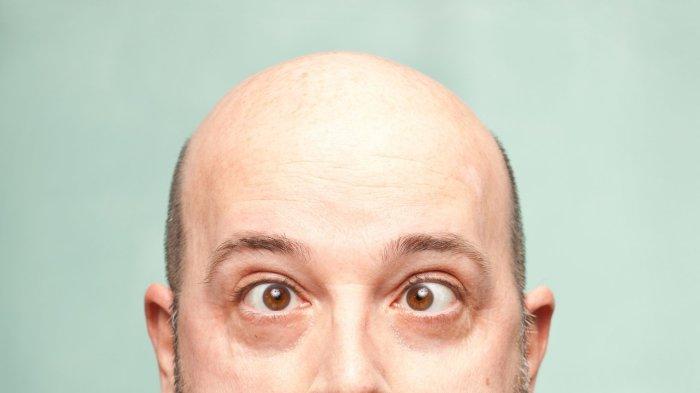 5 Arti Mimpi Botak Menurut Pandangan Islam, Apakah Ini Pertanda Buruk ...
