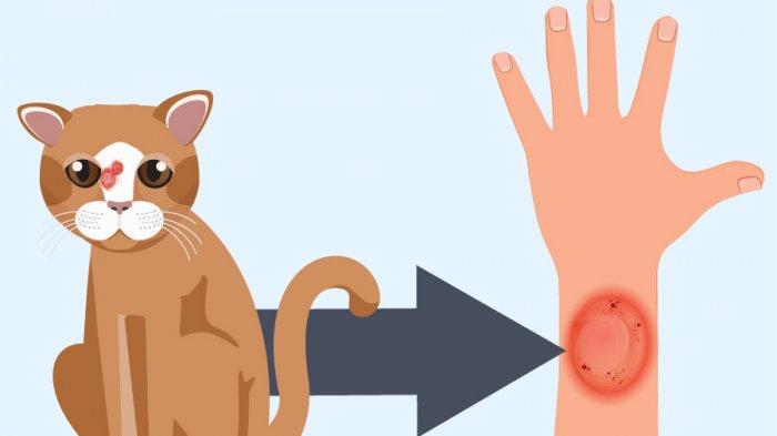 4 Jenis Jamur Ringworm yang Menyerang Manusia, Kucing Bukan Satu ...