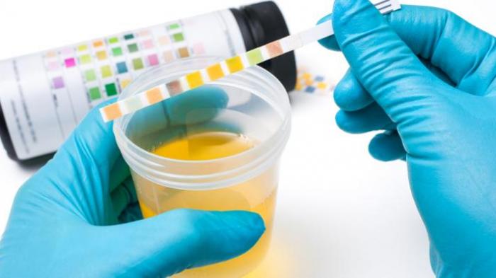 Urine Bisa Obati Infeksi Jamur di Kaki? - Tribunjogja.com