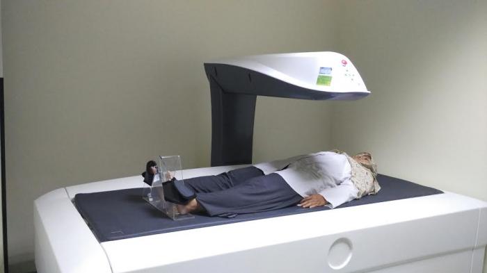 Periksa Massa Tulang Anda untuk Cegah Osteoporosis - Tribunjogja.com