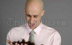 Pria Berkepala Botak Rentan Penyakit Jantung - Tribunjogja.com