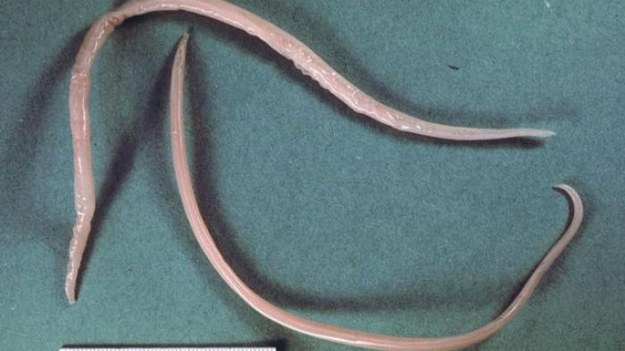 Penyakit Cacingan di Yogya Capai 165 Kasus - Tribunjogja.com