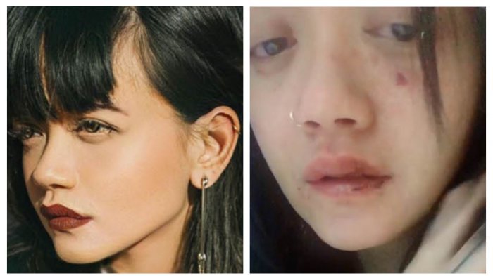 Sederet Fakta yang Jarang Diketahui tentang Model Cantik Dylan Sada ...