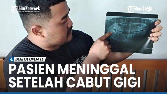 Pasien Meninggal Setelah Cabut Gigi Graham, Dinkes Turun Tangan ... Pasien Meninggal Setelah Cabut Gigi Graham, Dinkes Turun Tangan ...