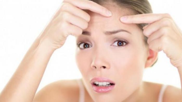 Kenali Tiga Jenis Jerawat Ini dan Cara Penangananya - Tribunjogja.com