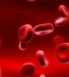 Kenali Gejala Penyebab Anemia pada Remaja - Tribunjogja.com