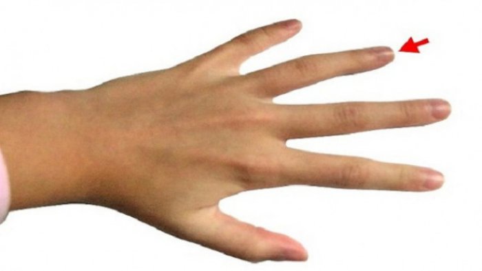 Ukuran Jari Manis Bisa Menungkap Perangai Pria Pasanganmu - Tribunjogja.com