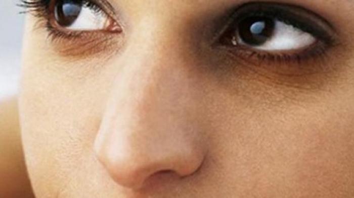 Terganggu dengan Kantung Mata? Ini 5 Cara Menghilangkannya secara Mudah ...
