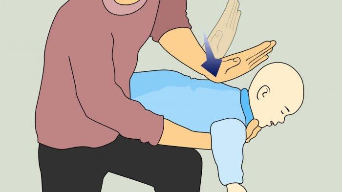 Anda Harus Tahu, Ini Pertolongan Pertama pada Bayi dan Orang Dewasa ...