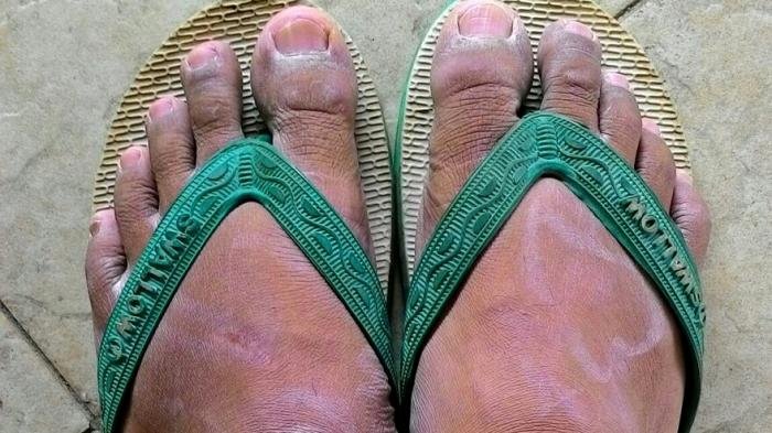 Hati Ini Tersayat dan Air Mata Menetes saat Lihat Sandal Jepit Lusuh ...