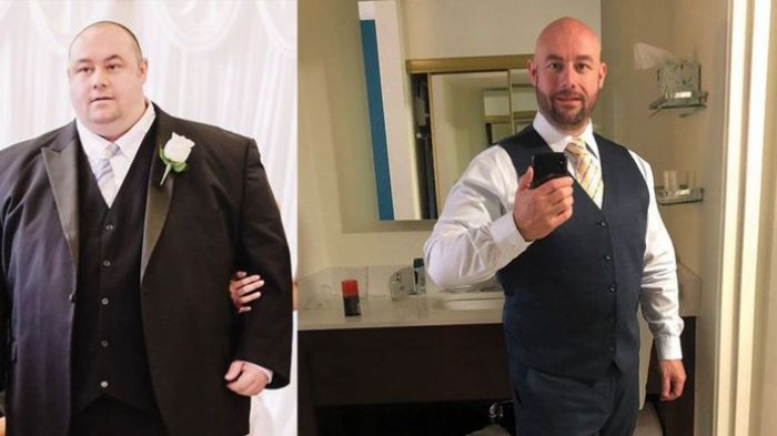 Pria Ini Sukses Turunkan Hingga 100kg Berat Badannya - Halaman all ...