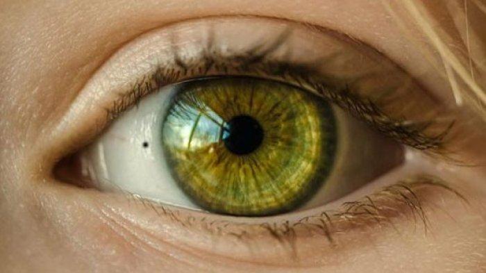 Arti Tahi Lalat Di Sekitar Mata, Di Bola Mata Hingga, Di Antara Kedua ...