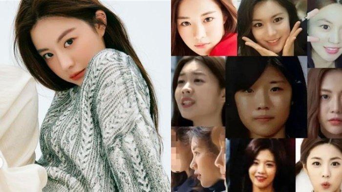 Foto Lawas Go Yoon Jung Tersebar, Dituding Lakukan Operasi Plastik ...