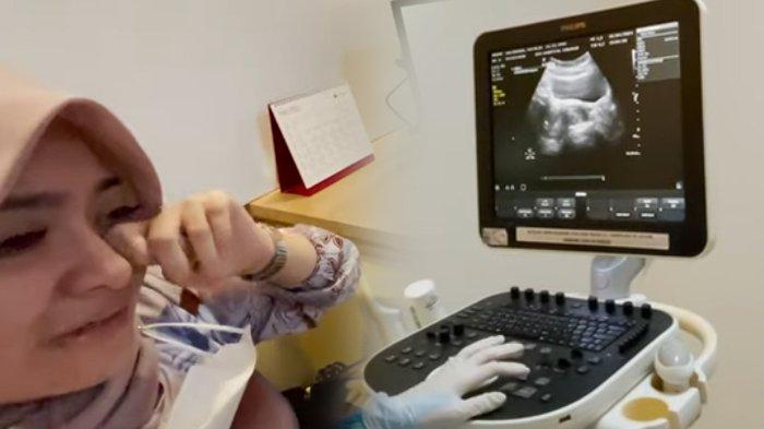 Sudah Mantap Cerai, Tangis Nathalie Holscher Pecah saat Periksa Kandungan, Hamil Anak Sule ...