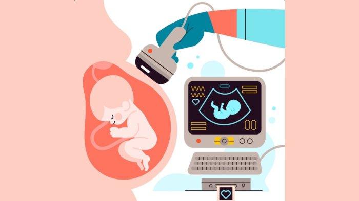Hadits Tentang Bayi dalam Kandungan Ibu Hamil, Ini Hukum Aborsi Sebelum ...