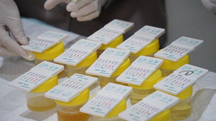 Deteksi Penyalahgunaan Narkoba 70 Personel Rumah Sakit Bhayangkara Tes ...
