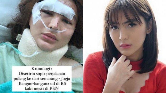 Angela Lee Kecelakaan hingga Koma 2 Hari, Profil Selebgram Berjuluk Barbie Jowo, Kisahnya Dulu ...