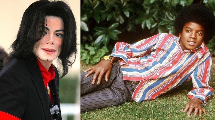 Sejarah 27 Januari: Kisah Michael Jackson Alami Insiden Tragis Saat ...