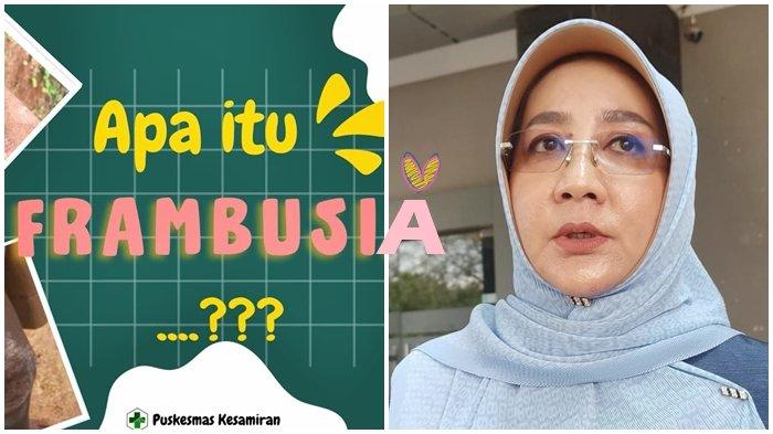 Mengenal Bahaya Penyakit Frambusia, Bupati Berau Sri Juniarsih ...