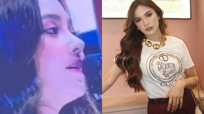 Potret Mahalini yang Viral Bikin Pangling Usai Diduga Operasi Hidung, Perbedaan Dulu dan ...