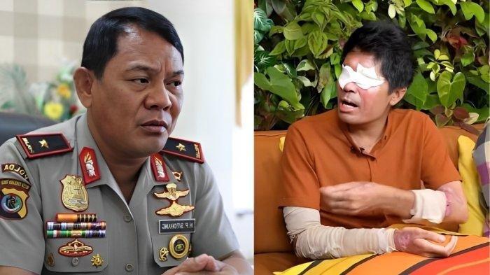 Profil Irjen Purn Ricky Sitohang, Polisi yang Jengkel dengan Tangisan ...