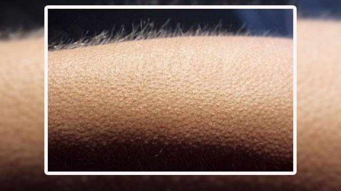 Anda Pernah Mengalami Merinding, Ternyata ini 4 Penyebabnya, Salah ...