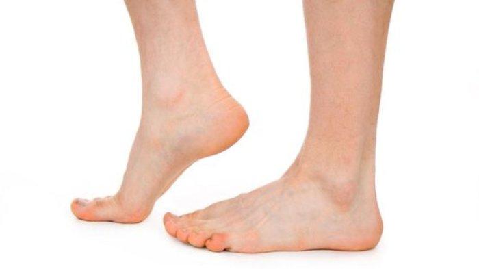 Heboh Mata Kaki Hitam Tanda Perempuan Tak Mulus, Ini 5 Cara ...