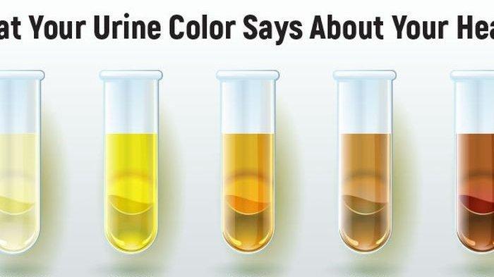 3 Tanda Urine Anda Normal dan Cara yang Bisa Dilakukan Agar Sistem ...