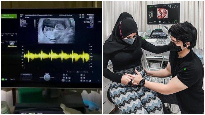 Atta Halilintar Menangis Umumkan Usia Kehamilan Aurel Hermansyah: Sehat Kuat ya Anakku ...