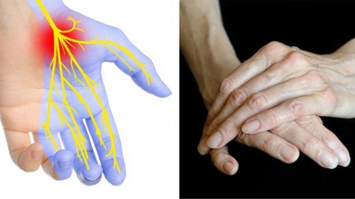 Perhatikan Tangan Anda Sekarang, 7 Kondisi Tangan ini Ternyata Bisa ...