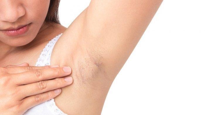 Anda Pilih Cukur Atau Mencabut Bulu Ketiak, Cek Mana yang Lebih Baik - Tribunkaltim.co